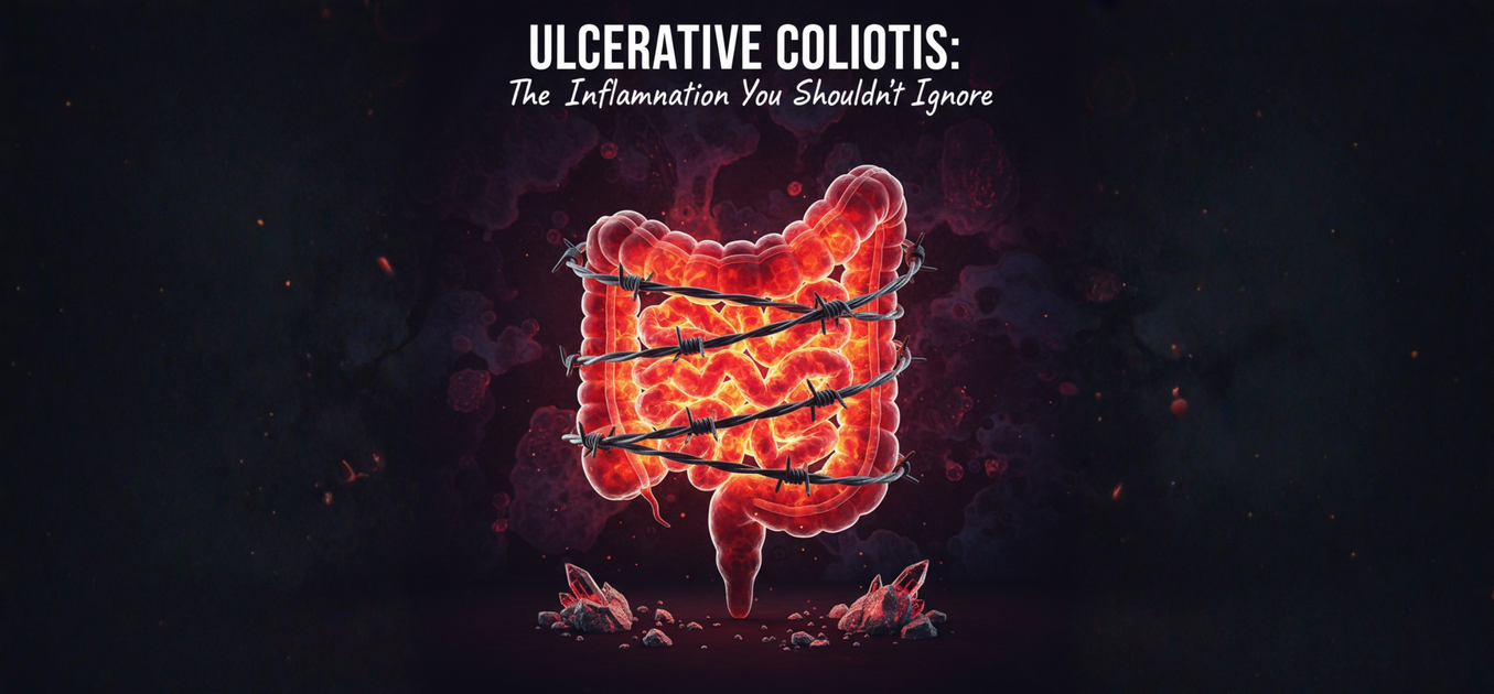 What Is Ulcerative Colitis? Understanding This Chronic Gut Condition ...